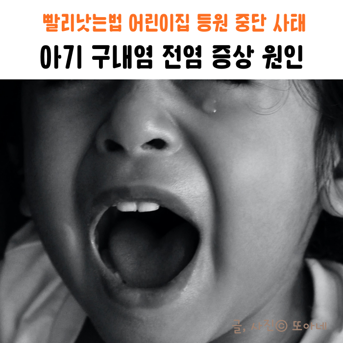 요즘 너도나도 아기 구내염 전염 증상 원인 빨리 낫는 법 어린이집 등원 중단 네이버 블로그