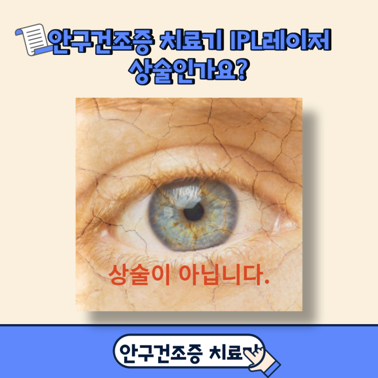 안구건조증 치료기 Ipl레이저 상술인가요 네이버 블로그