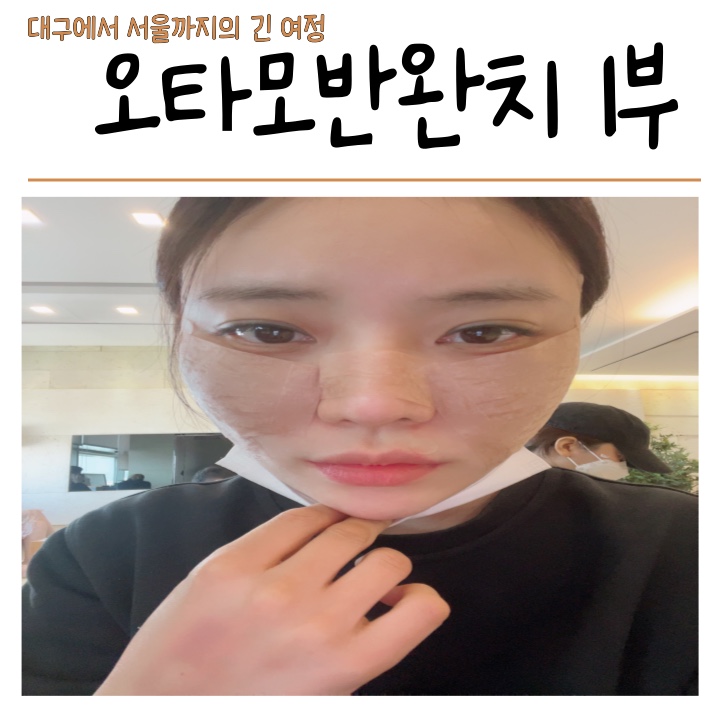 오타모반제거 후기1부 저의 오타모반은 치료 가 아닌 완치가 목적입니다 양측성오타모반 레이져 제거 기미 잡티 주근깨
