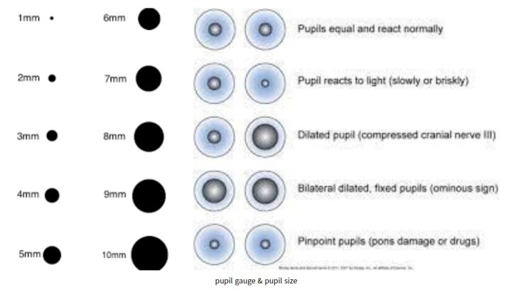 [신규RN] #6. 기초 신체사정 (GCS, Motor Power Grade, Level Of Consciousness ...