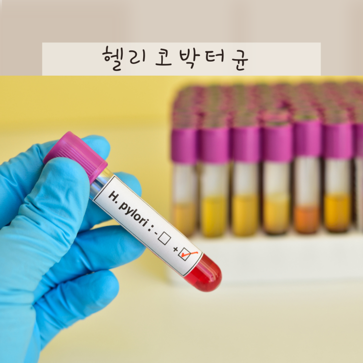 헬리코박터균 검사 원인 증상 전염 약 제균치료 간단하게 알고 있자 네이버 블로그