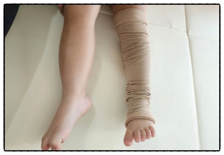 임산부 압박스타킹 발붓기 다리쥐 예방 위해 사용 : 네이버 블로그