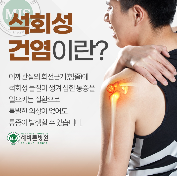 특별한 외상 없어도 발병 가능한 어깨 석회성 건염 원인과 치료방법 세바른병원 비수술 핌스치료 네이버 블로그