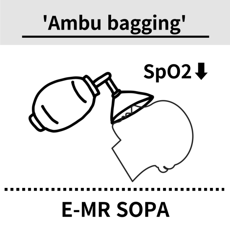 Intubation 전 단계 환자의 갑작스러운 SpO2 저하 : MR SOPA(Ventilative Corrective step ...