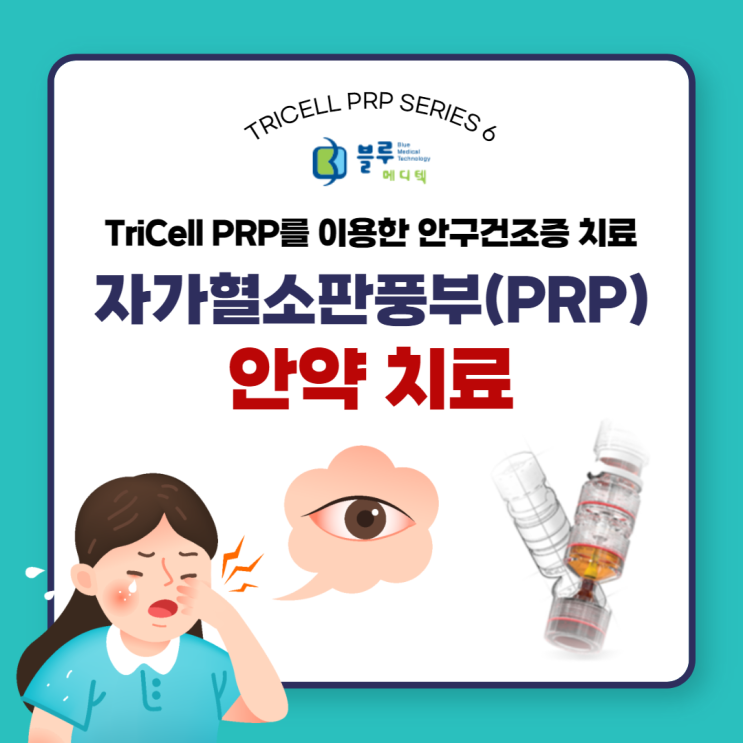 [정형외과 의료기기] TRICELL PRP SERIES 6 : TriCell PRP를 이용한 안구건조증 치료 "자가혈소판풍부 ...