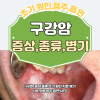구강암 증상 종류 초기 원인 치료 병기 혀 잇몸 음주 흡연 사진 네이버 블로그