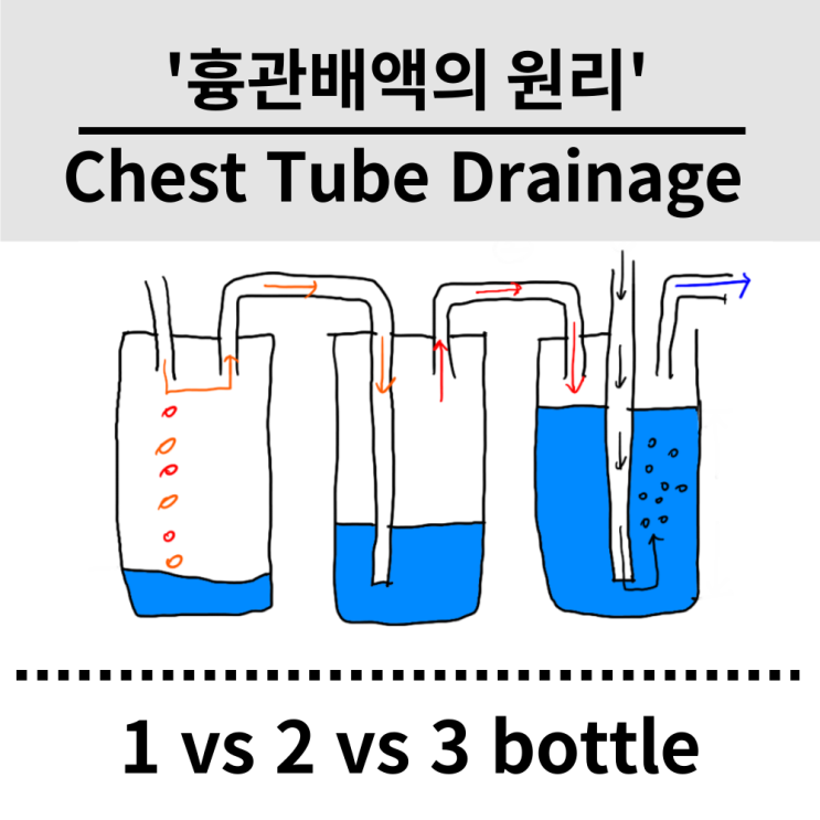 흉관배액의 원리 (Chest Tube Drainage : CTD) : 1 bottle vs 2 bottle vs 3 bottle ...