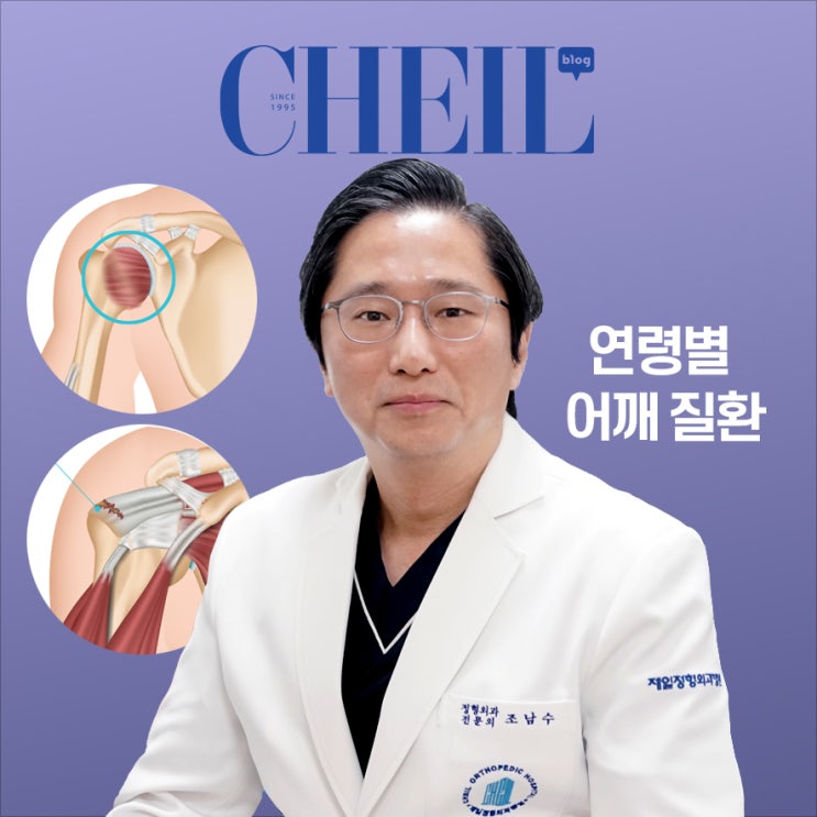 연령별 어깨 질환 10~20대 관절외순 손상 30대 어깨충돌증후근 40~50대 석회성건염 오십견 60대 회전근개