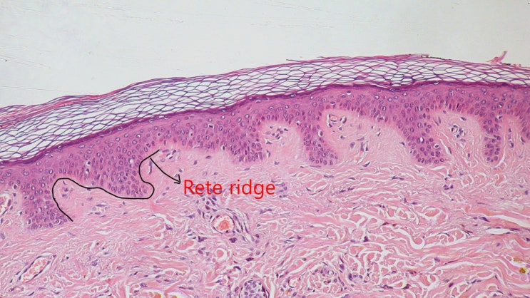 토닝은 왜 꼭 10회씩 해야해요? / 다산 피부과 / 도농피부과 / 매일빛나는의원 : 네이버 블로그