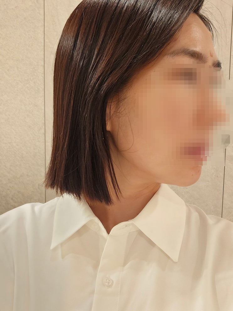 티타늄리프팅 효과 통증 가격 주기 압구정로데오피부과 40대 피부관리 네이버 블로그