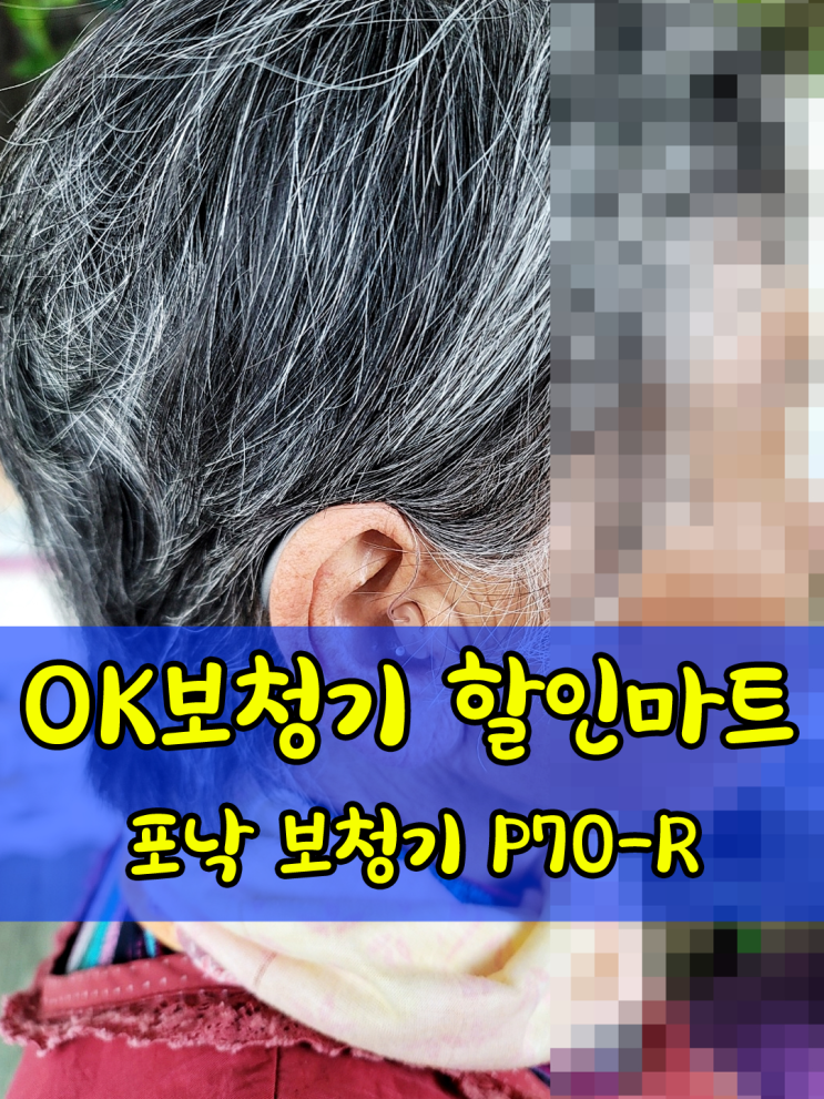 청주 보청기 혼합성 난청 착용 사례 정부 지원 보청기 포낙 P70 R 네이버 블로그
