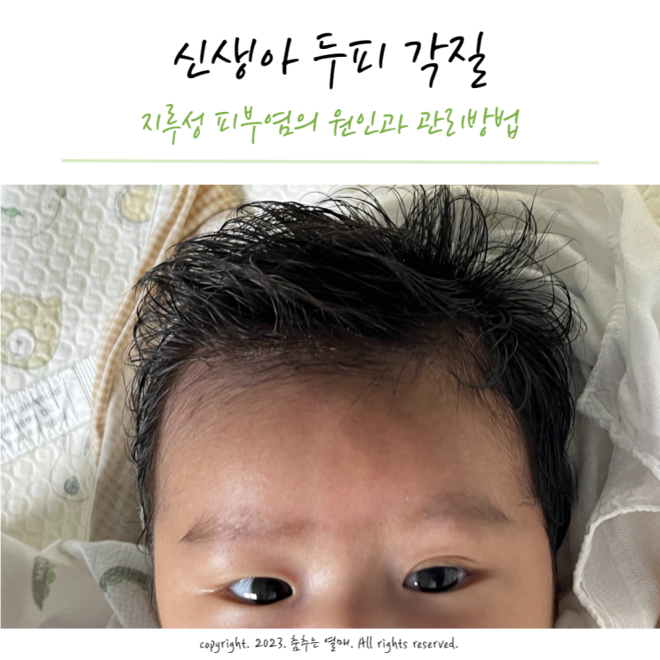 신생아 두피 각질 비듬 지루성 피부염일까 해결방법은 네이버 블로그
