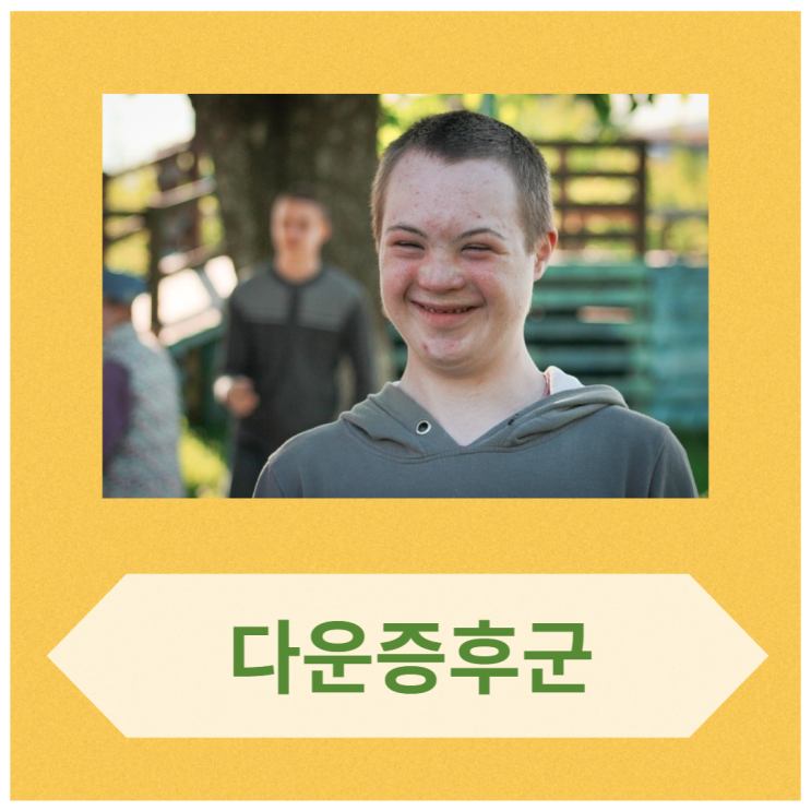 다운증후군 얼굴 특징 증상 다운증후군 치료 방법 네이버 블로그