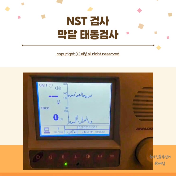 막달 태동 NST검사 비용 환급 그래프 보는 법까지 : 네이버 블로그