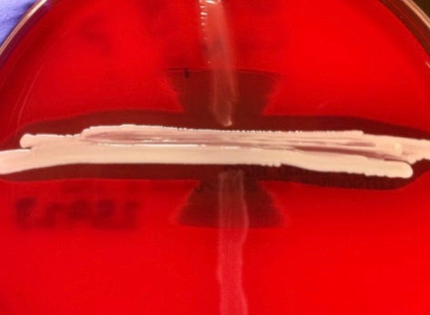 Listeria monocytogenes 판별을 위한 CAMP test : 네이버 블로그