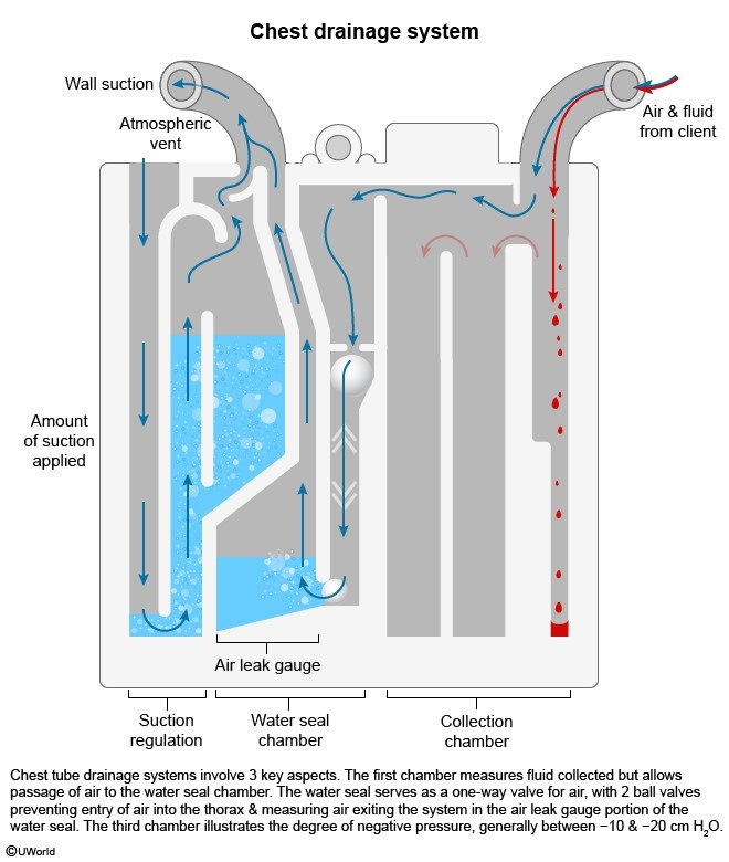 [NCLEX] Chest tube : 네이버 블로그
