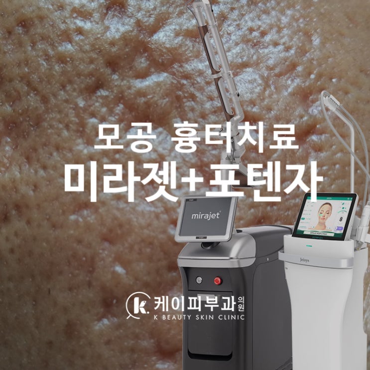 해운대피부과 모공 흉터 치료 미라젯 포텐자 레이저 효과 및 가격 네이버 블로그