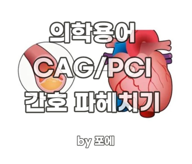 의학용어 CAG, PCI :: 관상동맥조영술, 경피적관상동맥중재술 목적,시술 과정, 시술 전후 간호 : 네이버 블로그