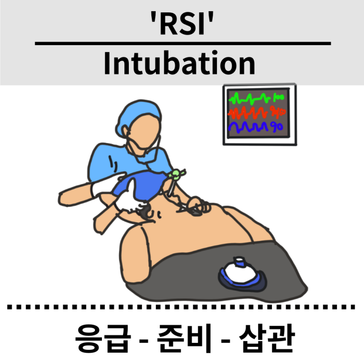 응급상황에서의 기관삽관(Intubation) : RSI(Rapid Sequence Intubation) : 네이버 블로그
