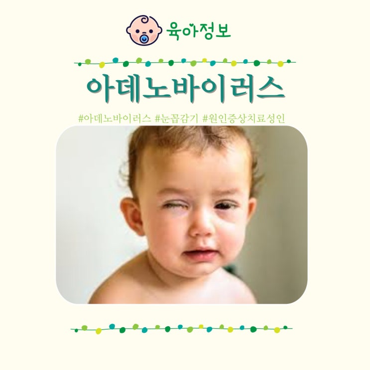 아데노바이러스 눈꼽감기 바이러스 증상 전염 치료 어린이집 성인 네이버 블로그