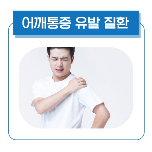 어깨 통증 대표 질환의 원인 및 증상오십견어깨충돌증후군석회성건염회전근개증후군어깨슬랩병변 네이버 블로그