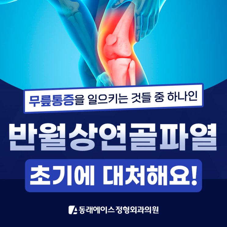반월상연골판파열 증상이 심해서 걸을 수가 없어요 네이버 블로그