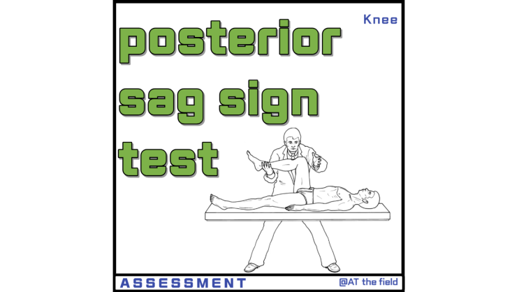 Posterior Sag sign Test(후방 처짐 징후 검사) / Godfrey's test,Step off Test ...