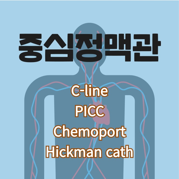 중심정맥관의 종류, C-line, PICC, Hickman cath, Chemoport 어떤 상황에 어떤 것을 넣지? 관 삽입 ...