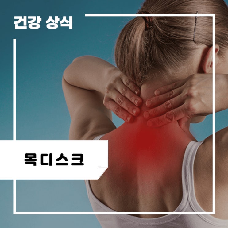 목디스크 초기 증상 및 원인 치료방법 수술 통증 완화 운동과 스트레칭 두통 가슴통증 팔저림 손저림 어깨통증
