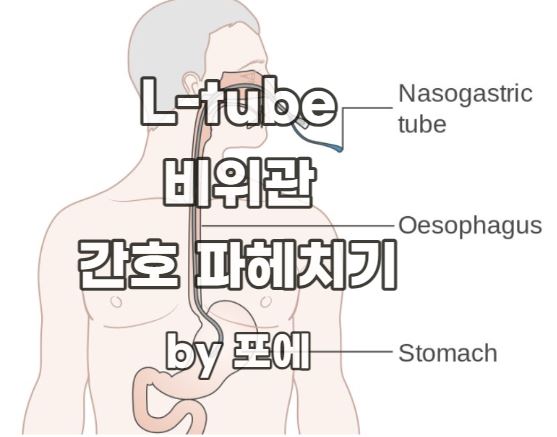 의학용어 L-tube :: 비위관 정의와 삽입 목적, 삽입방법, 주의사항, 위관영양까지 : 네이버 블로그