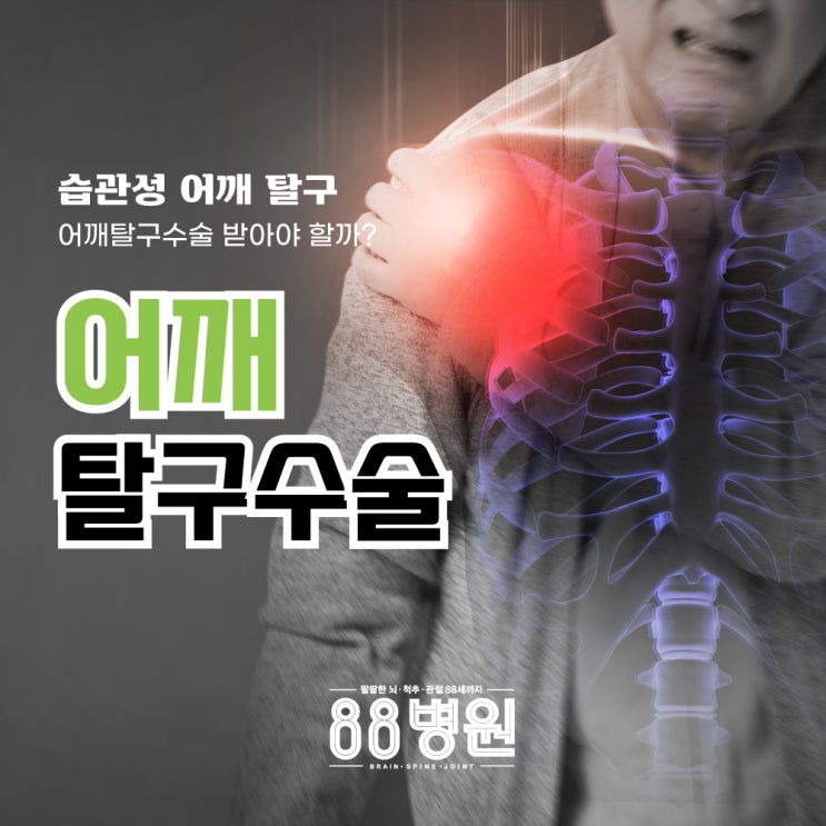 서울 면목동 정형외과 88병원 습관성 어깨 탈구 수술받아야 되나요어깨 통증 네이버 블로그