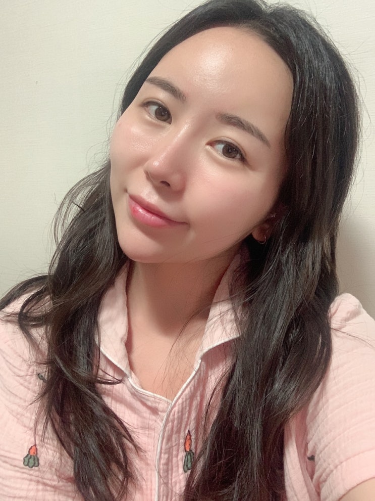 콜라겐부스터 신논현역피부과에서 이마 관자놀이 미희주사 받은 후기 네이버 블로그