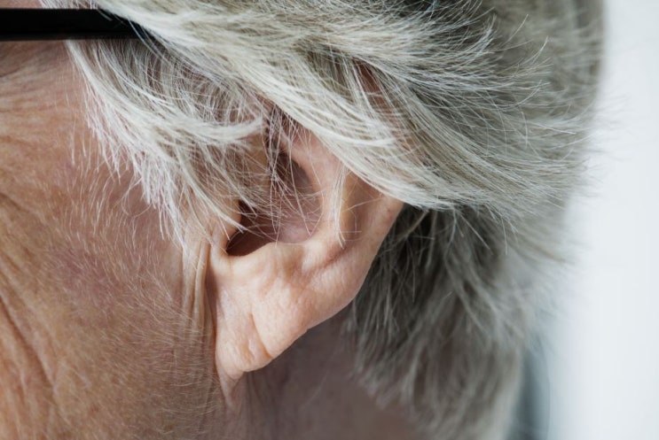 귓볼 주름과 치매 : Frank Sign : 네이버 블로그