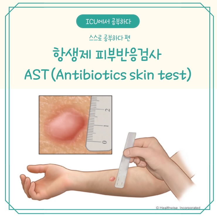 [ICU에서 공부하다] 항생제 피부반응검사 AST(Antibiotics skin test) : 네이버 블로그