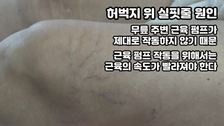 409. 무릎 근육 펌프 작동을 위한 KSNS KSS 근육 속도 강화 스도 방법 : 네이버 블로그