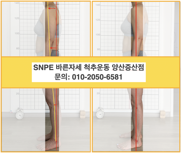 SNPE 양산 물금 증산 체형교정 잘하는곳 추천 SNPE바른자세척추운동으로 척추중립 지켜볼까요:) - 양산snpe Before&After : 네이버 블로그