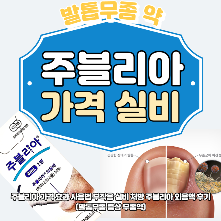 주블리아 가격 효과 사용법 부작용 실비 처방 주블리아 외용액 후기 발톱무좀 증상 무좀약 네이버 블로그