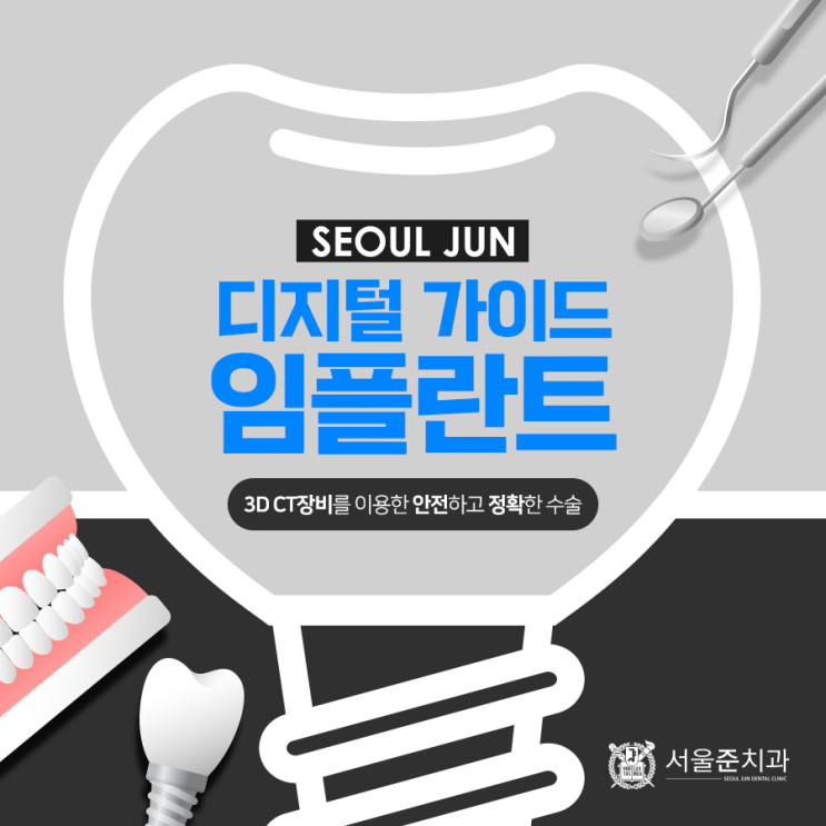 한성백제역임플란트 성공률 높은 임플란트를 원한다면 네이버 블로그