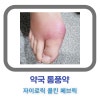 약국 통풍약 콜키신콜킨정 페북소스타트페브릭정 알로푸리놀자이로릭 효능 효과 부작용 성분 분석 네이버 블로그