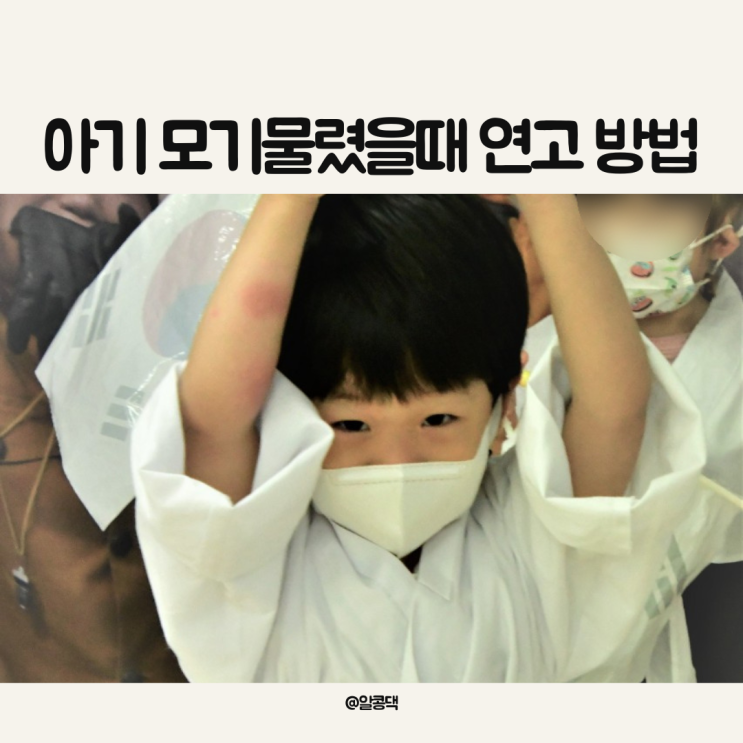 아기 모기 물렸을때 연고 모기 알레르기 비판텐 에스로반 리도맥스 방법 네이버 블로그