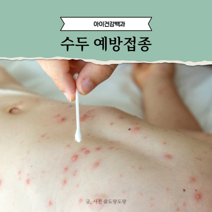 아기 수두 예방접종 시기 부작용 추가접종 가격 네이버 블로그