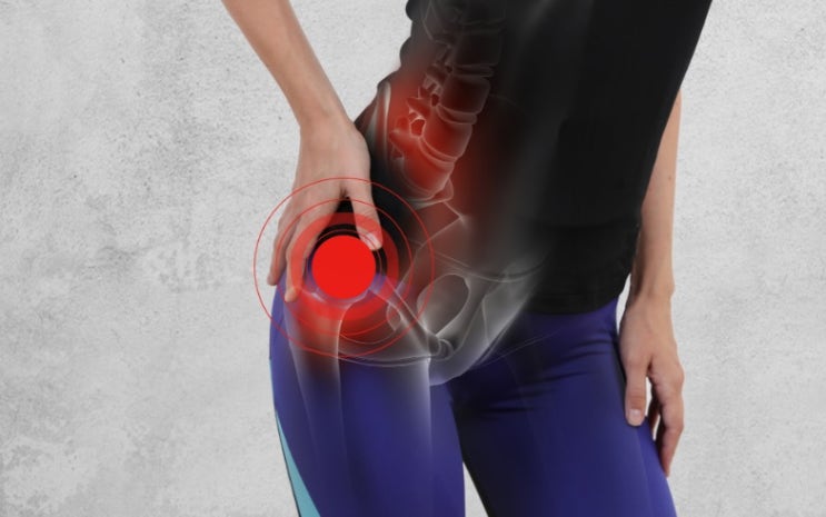 흉요추증후군 ( TL junction syndrome, Maigne syndrome) : 네이버 블로그