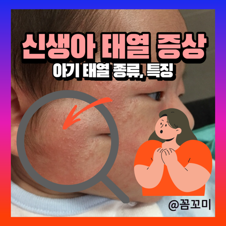신생아 태열 증상 원인 아기태열 관리 네이버 블로그