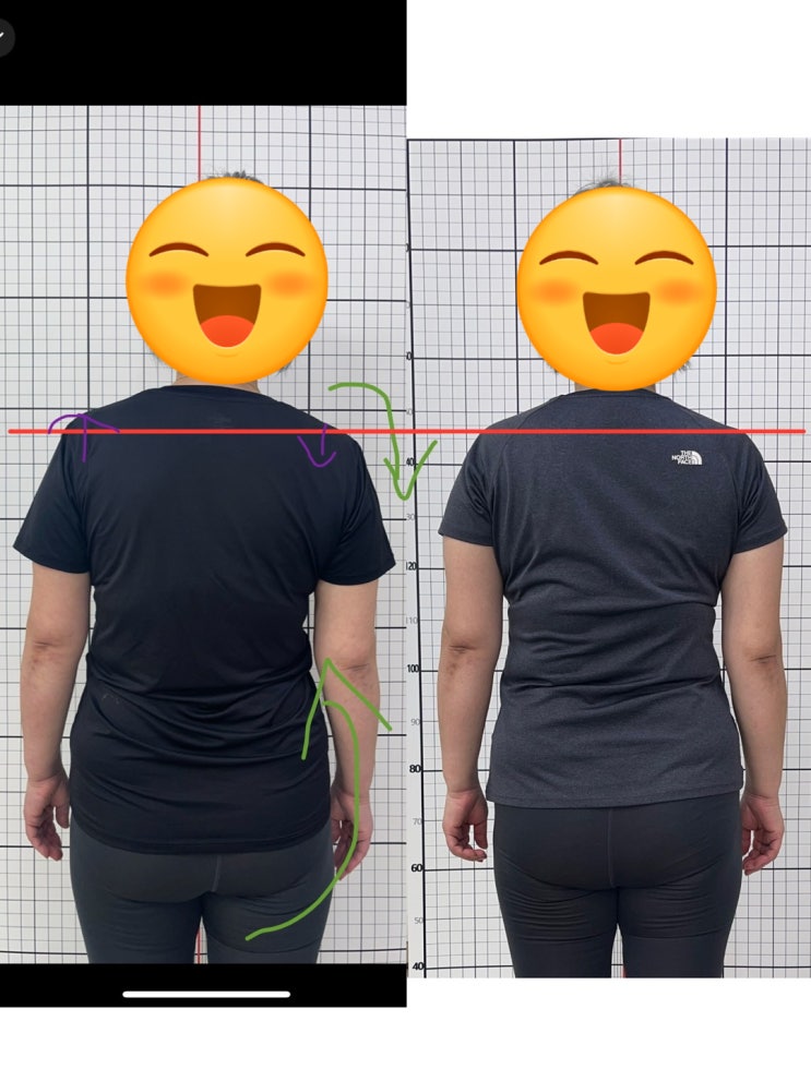 길음동길음뉴타운미아사거리미아동길음길음동부센트레빌롯데캐슬클라시아 필라테스 굽은등 골반틀어짐 체형교정 바른자세