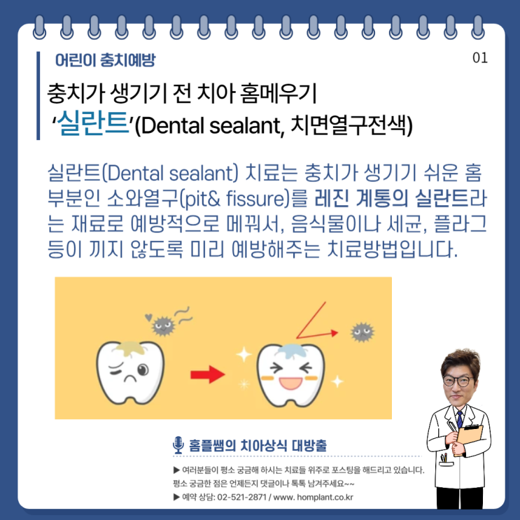 어린이 충치예방 충치가 생기기 전 치아 홈메우기 ‘실란트sealant치면열구전색 치료 알아보기 네이버 블로그