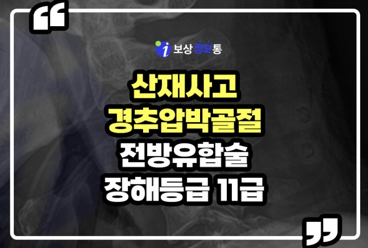 경추전방유합술 수술 후 실제후기 산재 장해등급 11급 판정사례 네이버 블로그