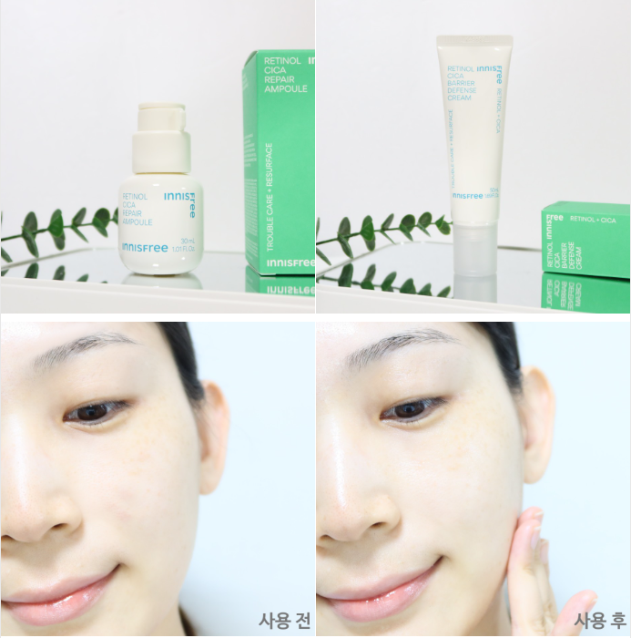 트러블끝장케어 이니스프리 레티놀 시카 흔적 앰플 And 흔적 장벽 크림 사용후기 네이버 블로그