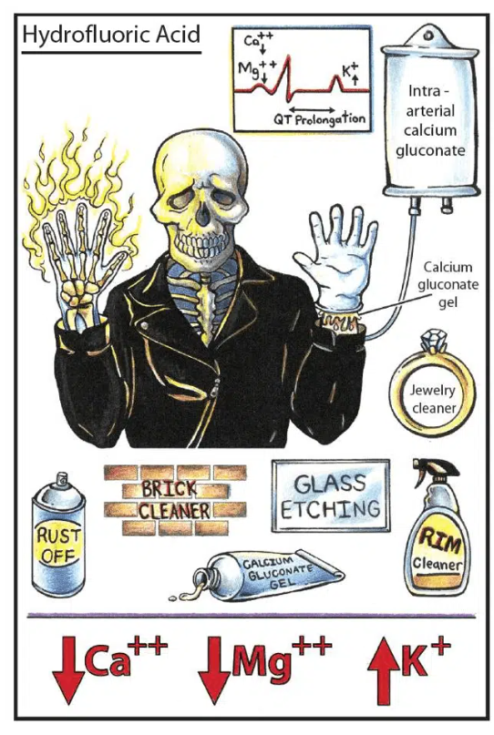 불산 중독, 불산 노출 (Hydrofluoric Acid 불화 수소산) : 네이버 블로그