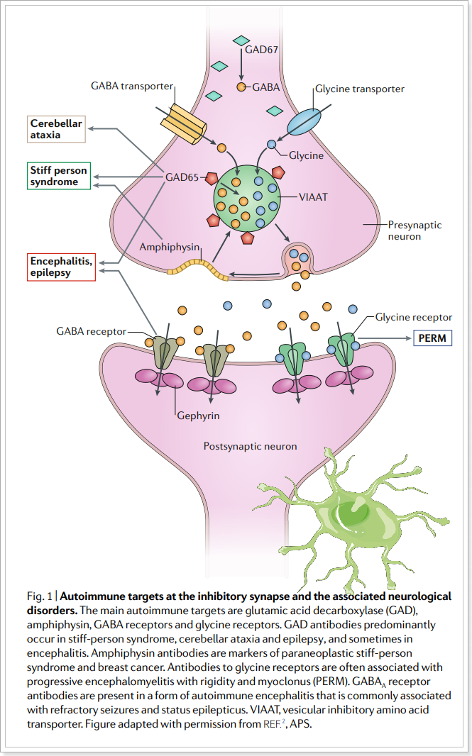 Anti-GAD antibodies 연관 신경 증후군 (강직인간증후군, 자가면역 뇌염 등) : 네이버 블로그