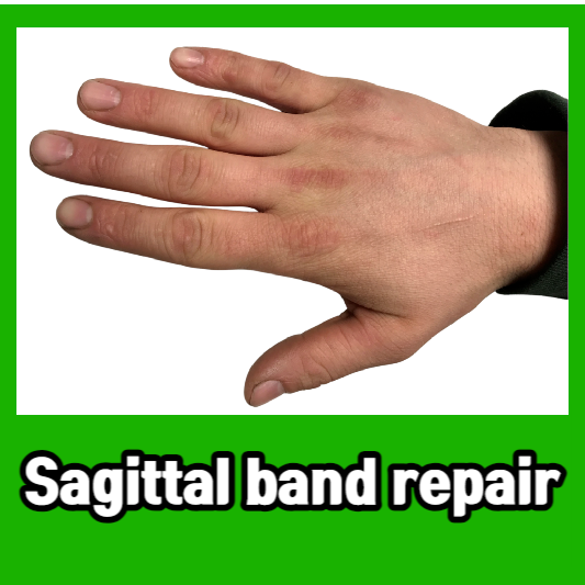 Sagittal band rupture repair 시상대 파열 재건술 수술 준비 수술 과정 : 네이버 블로그
